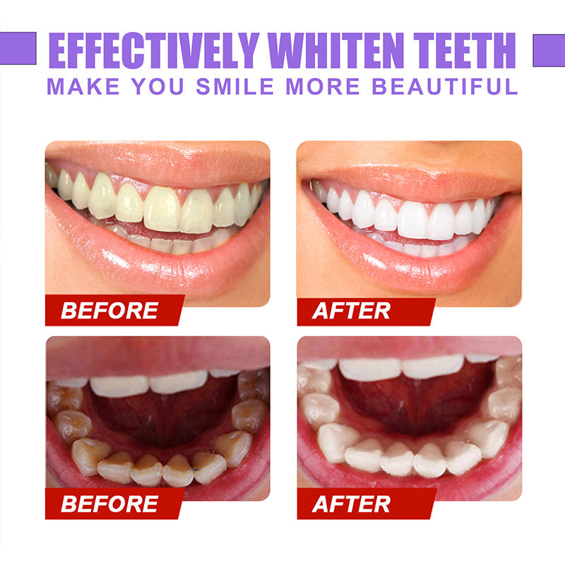 Dental Color Corrector – peonlyshop