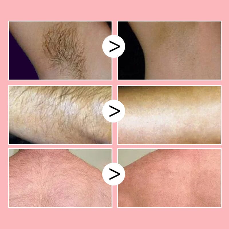 Honey Mousse Hair Removal Spray – peonlyshop